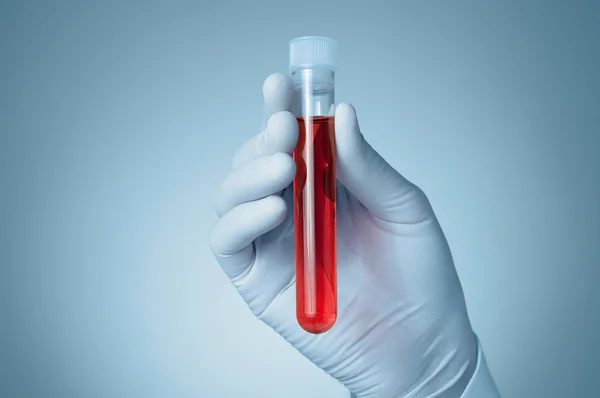 Lab in Devakottai | | My Lab Clinical Laboratory